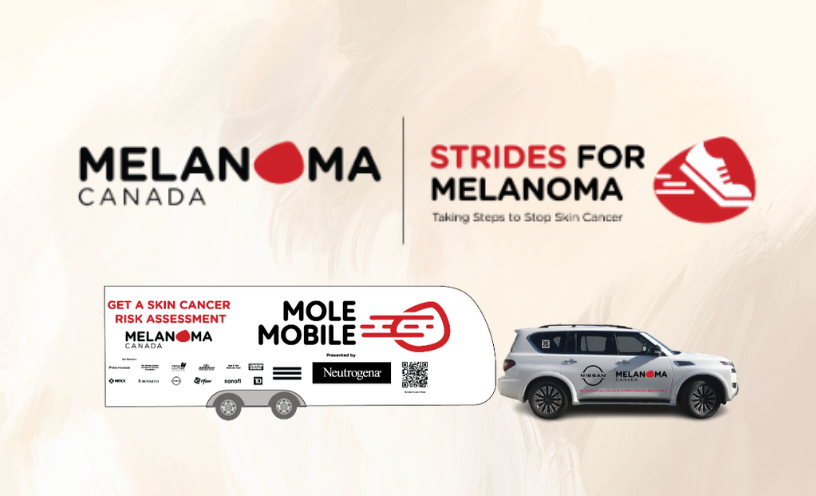 Mole Mobile: Canada's First Mobile Skin Cancer Screening Unit by Melanoma Canada